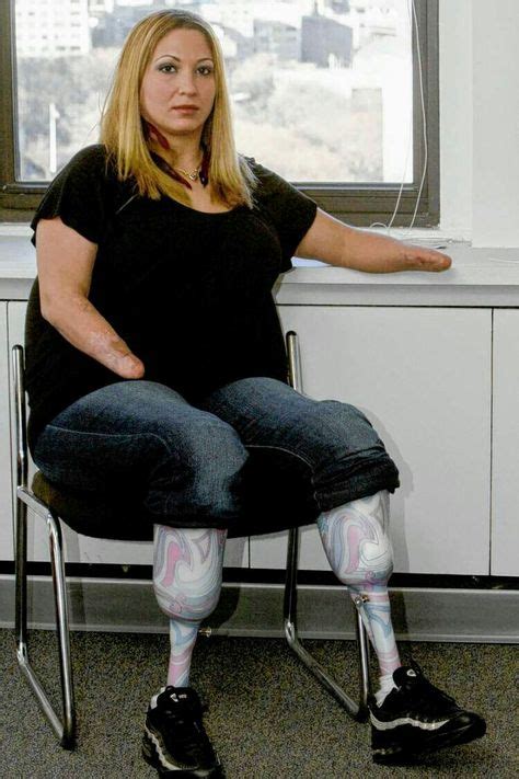 Quad Amps Ideas Amputee Quad Prosthetic Leg