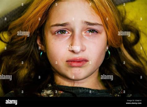 Little Sad Girl After Crying Crying Little Beautiful Girl With Sad Green Eyes And Frowning Face