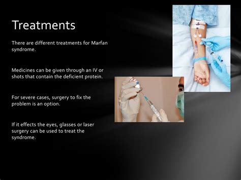Marfan Syndrome Treatment