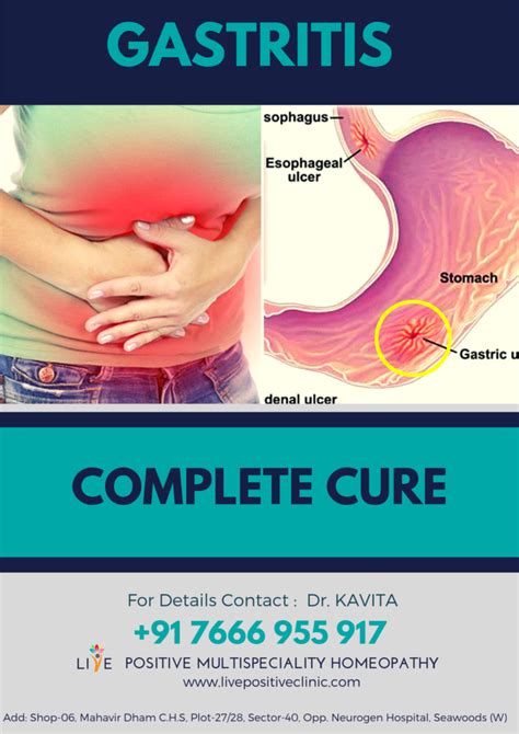 Gastritis Homeopathy Cures Permanently Live Positive