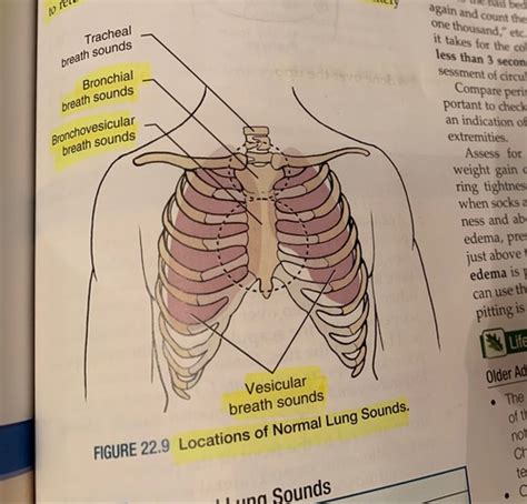 Medsurg Exam Respiratory Flashcards Quizlet
