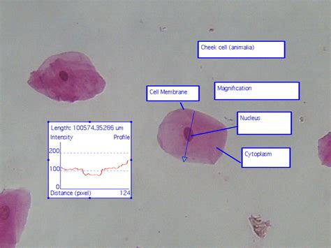 Human Cheek Cell Diagram Labeled