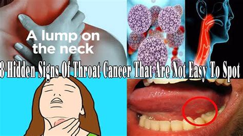 Early Warning Signs Of Oral Cancer