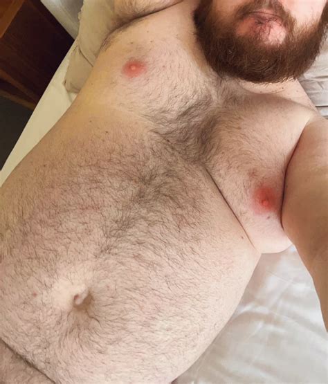 Lumbersnack On Twitter Im Still Sick And Now Ive Lost My Voice So