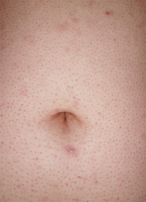 Swirly Outie Belly Button Telegraph