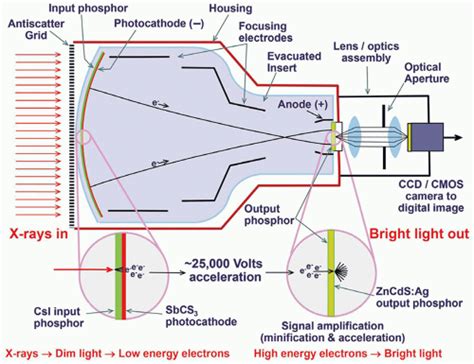 Fluoroscopy Radiology Key