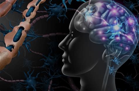 Multiple Sclerosis Types Symptoms Causes Diagnosis Treatment At