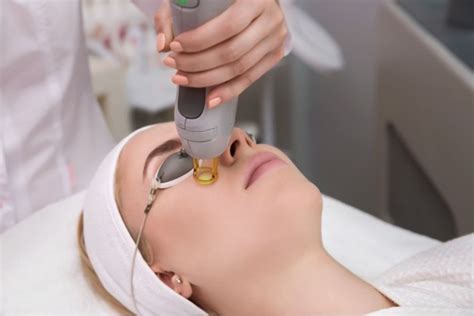 Laser Acroma QS a revolução no tratamento de melasma