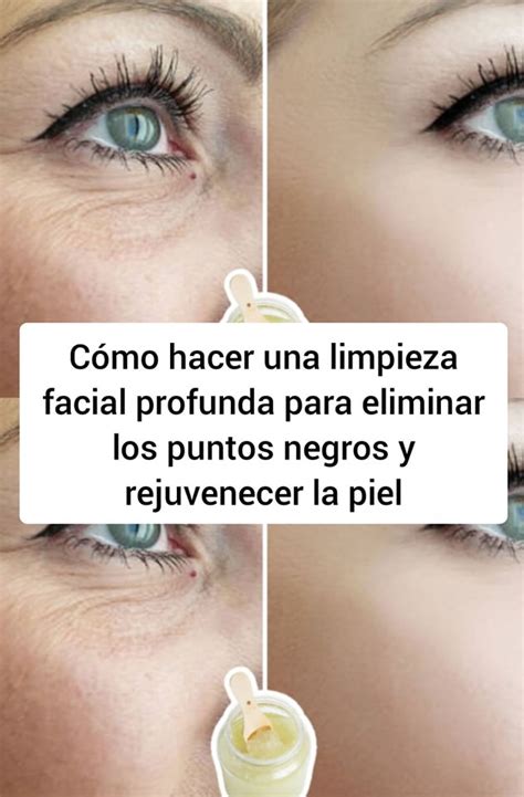 C Mo Hacer Una Limpieza Facial Profunda Para Eliminar Los Puntos Negros
