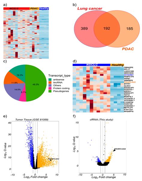 Total CfRNA Transcriptome Profiling Identify Potential Cancer