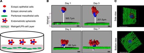 JCI Insight Spheroids As A Model For Endometriotic Lesions