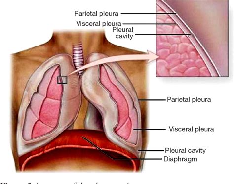 Figure 2 From Pleura Space Anatomy Semantic Scholar