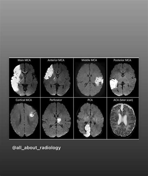 Pin Oleh Agnes Schep Di Mri Mrt Radiology Di Radiologi Anatomi