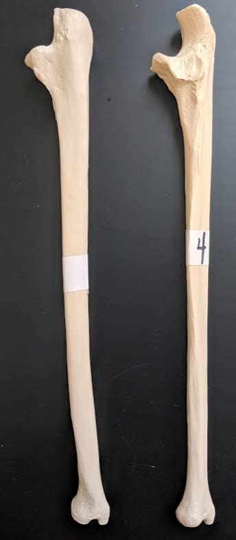 Ulna Diagram Quizlet