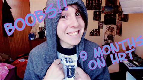 9 Months On Hormones MTF HRT Breast Development Fat Distribution