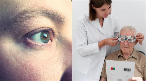 Glaucomul cauze simptome și opțiuni de tratament Importanța