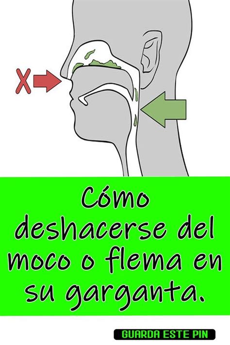 Pin En Remedios Caseros