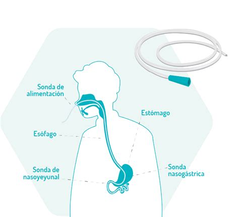 Higiene y cuidado de las Sondas Nestlé Health Science