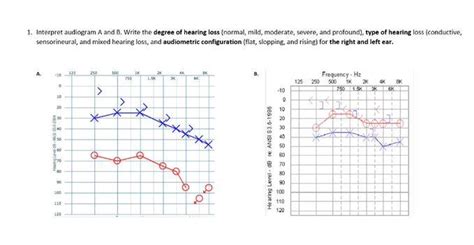 Solved 1 Interpret Audiogram A And B Write The Degree Of Chegg