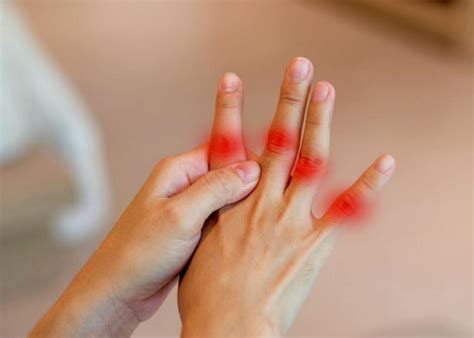 Methoden Zur Therapie Bei Arthrose Der Kleinen Gelenke