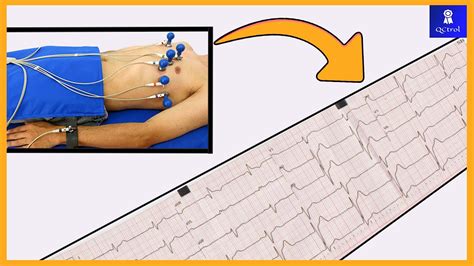 Aprende a tomar un electrocardiograma fácilmente Colocación de los