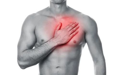 Icd Codes For Chest Pain Complete Guide