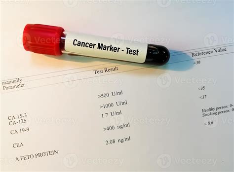 muestra de sangre para marcador de cáncer que incluye ca 125 ca 15 3