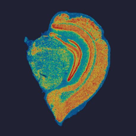 Stomics Stereo Seq Transcriptomics Set For Chip On A Slide X Cm