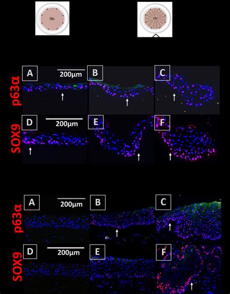 Progenitor Marker Distribution In Situ In Human Epithelial