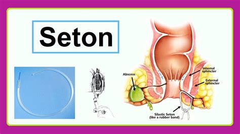 Seton YouTube