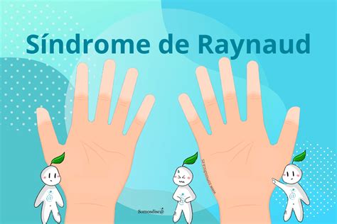 Qué es el Síndrome de Raynaud Somosdisc