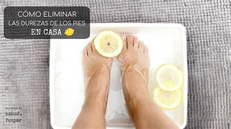 Cómo eliminar las durezas de los pies en casa YouTube