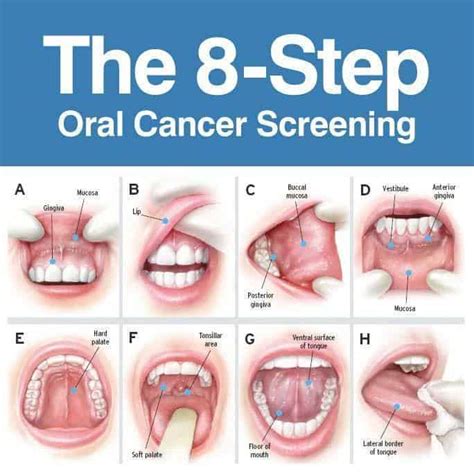 Oral Cancer Its Causes Symptoms Diagnosis And Prevention Corpus