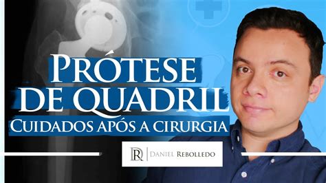 Prótese de Quadril Cuidados após a cirurgia YouTube