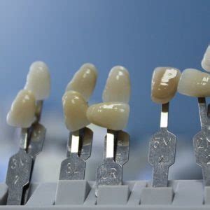 Qué es una corona dental Tipos y precios de fundas dentales