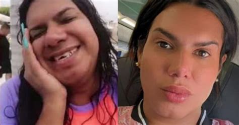 Así se veía Kimberly Irene la más preciosa antes de sus cirugías