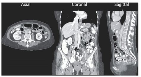 computed tomography radiology key