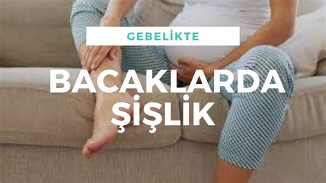 Gebelikte ayaklarda şişlik bacaklarda şişlik neden olur Serdar Akgün