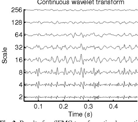 figure 2 from classification of neuromuscular disorders using wavelets and entropy metrics on