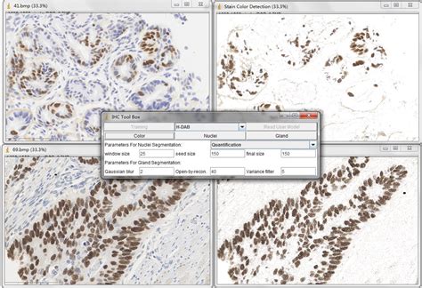 Imagej Ihc Ihc Toolbox Csdn