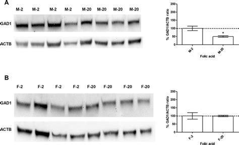 Western blot analysis showing the expression of GAD1 protein 25 μg in