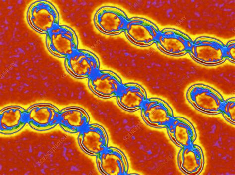 Chains Of Streptococcus Pyogenes Bacteria Stock Image B236 0093