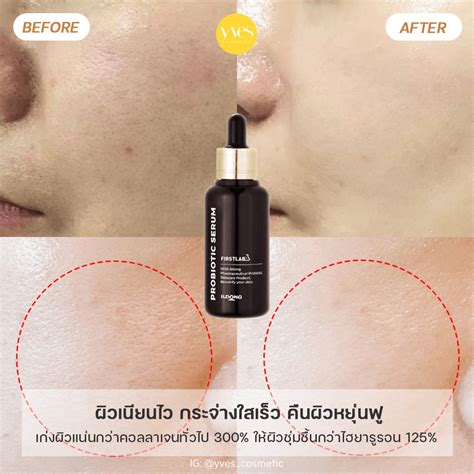 ILDONG Firstlab Probiotic Serum Yvescosmetic