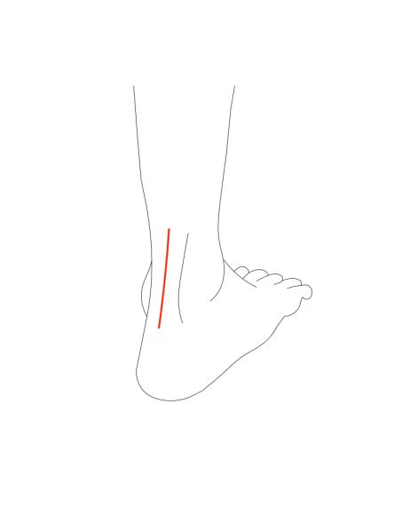 Tendinite Du Tendon D Achille Dr Bovier Lapierre