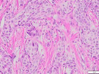 Human Lung Tissue Normal FFPE Sections