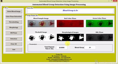 Blood Group Detection Using Image Processing Matlab Project With Source
