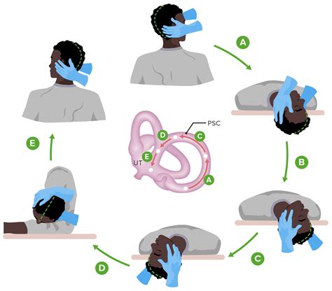 V Rtigo Concise Medical Knowledge
