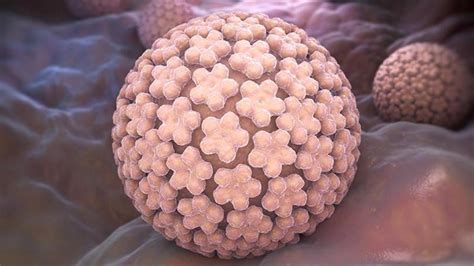 Qué es el virus del papiloma humano VPH Síntomas causas y cómo