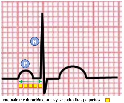 exagerar péndulo Novelista calcular intervalo pr clima Flexible