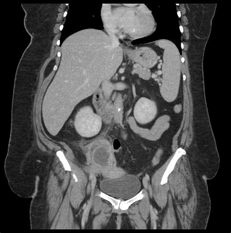 Journal Of Brown Hospital Medicine On Twitter Yo F With